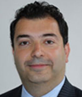 Conjunctivitis Treatment in Dubai